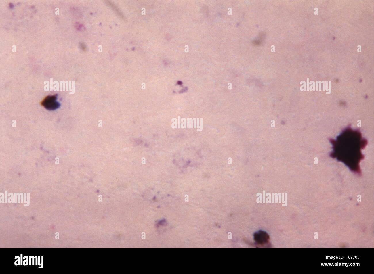 Thick film photomicrograph of a young growing Plasmodium malariae ...